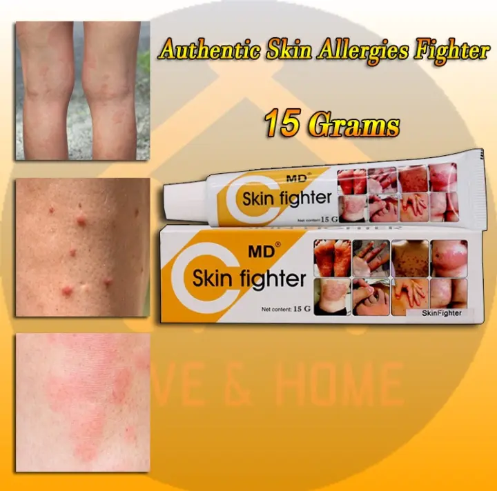 Original MD Skin Fighter Cream for Skin Allergies, Psoriasis, eczema ...