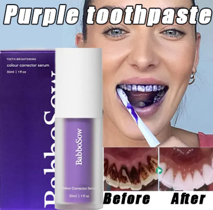 Purple Teeth Whitening Toothpaste For Pain Sensitive Teeth, Cleaning ...
